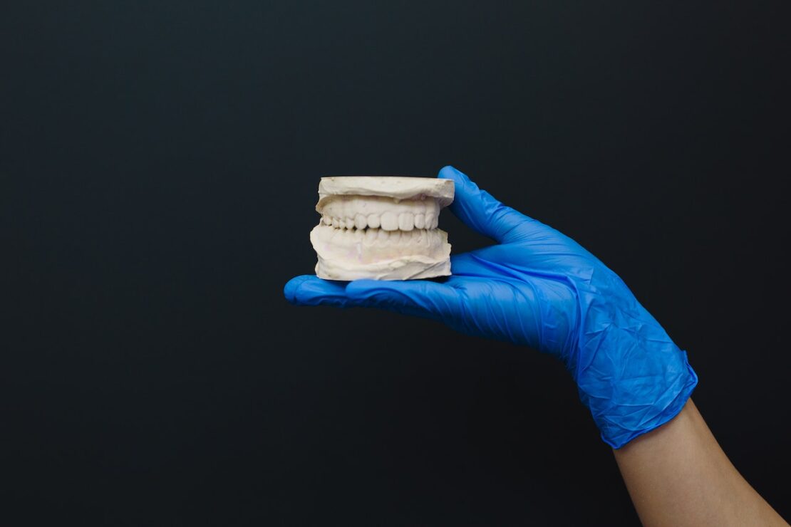 Dairy and Teeth | Park Lane Orthodontics